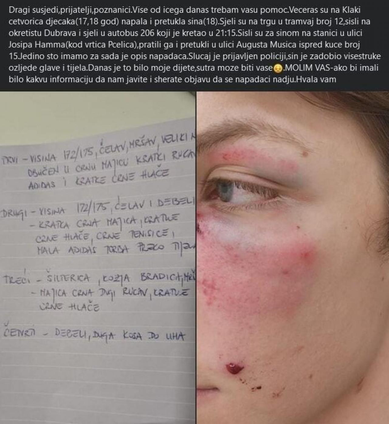 Jutarnji list - Trojica maloljetnika (15) brutalno premlatili dečka u Zagrebu pa završili u ...